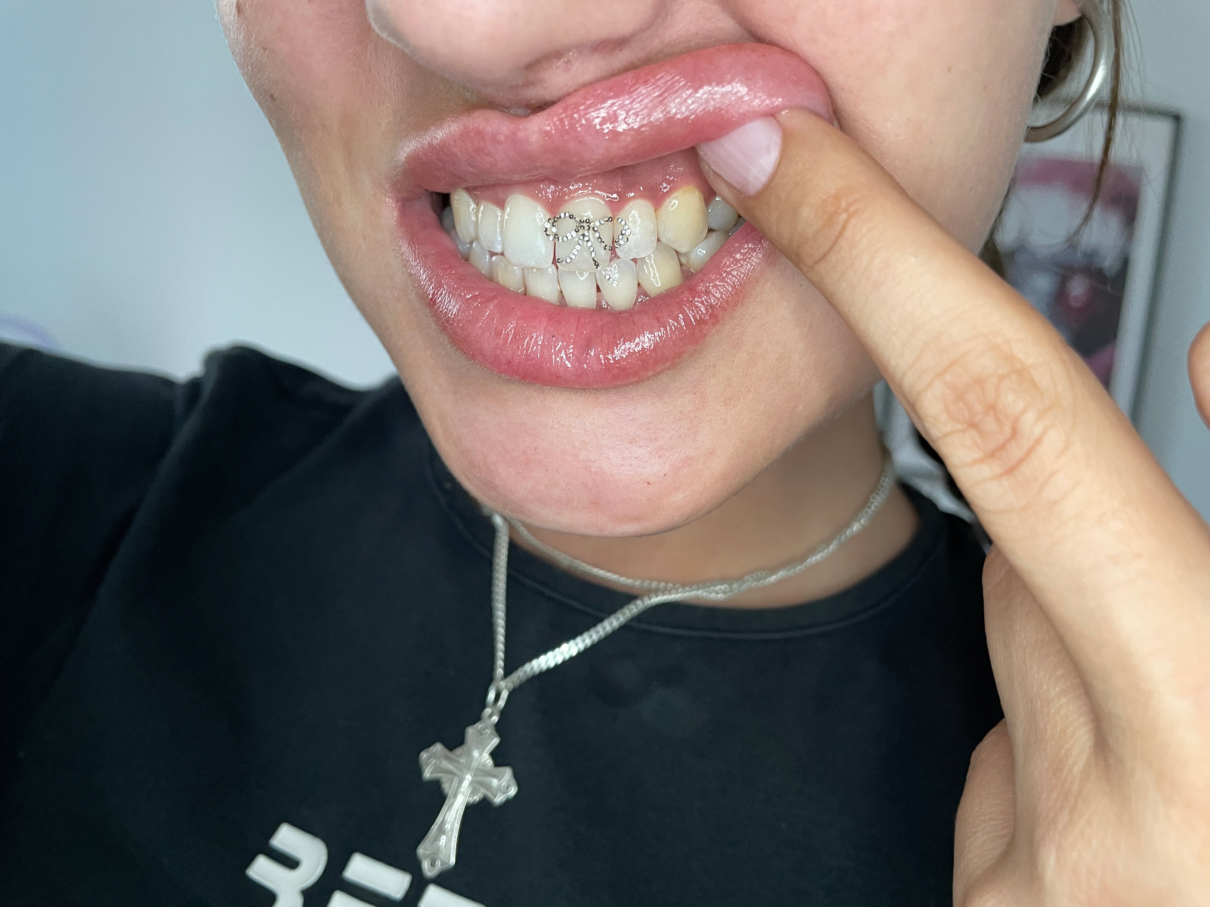 Micro Tooth Gems – SIA ICY